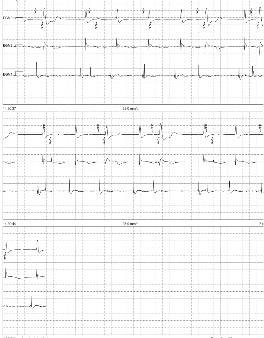 ECG 4.2 - MicroPort Academy