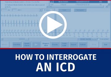 ICD courses - MicroPort Academy