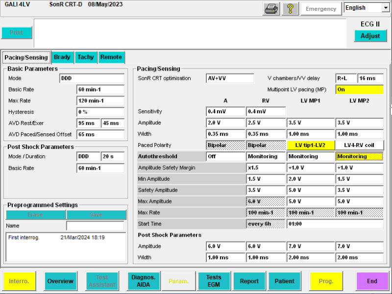 Programming the LV lead - MicroPort Academy