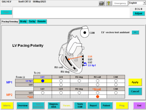 Programming the LV lead - MicroPort Academy